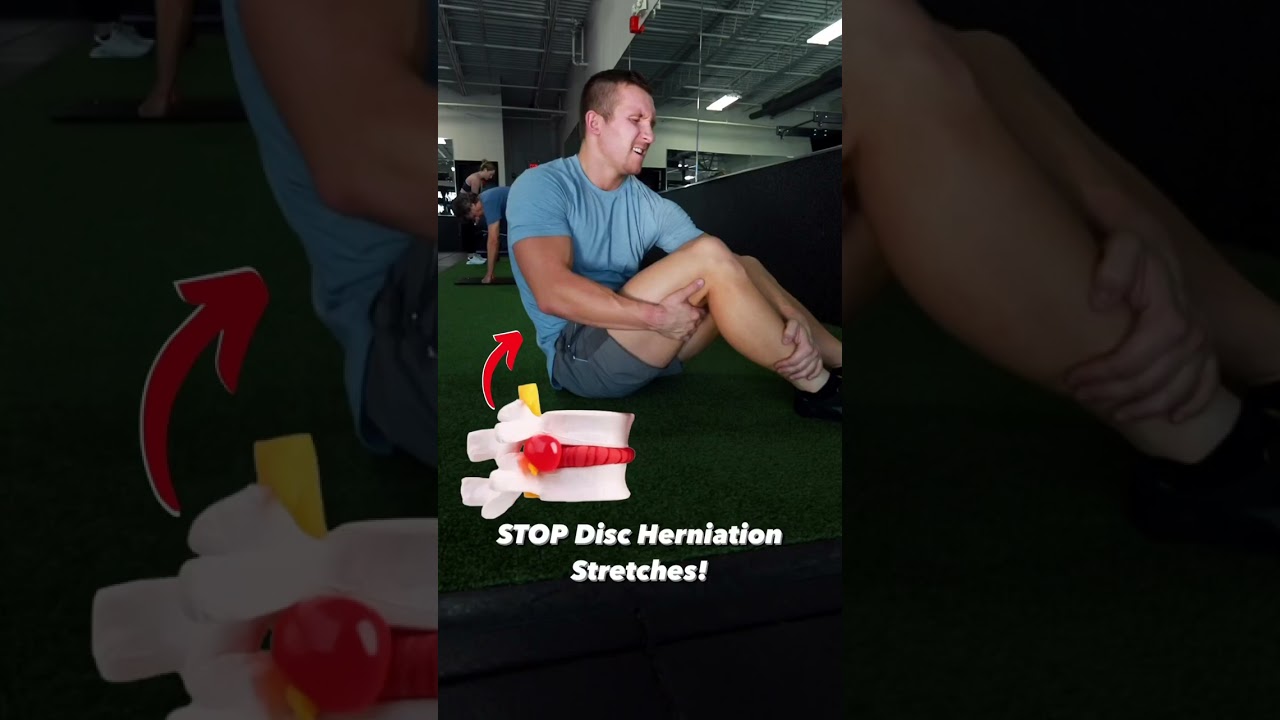STOP Stretching Your Disc Herniation!