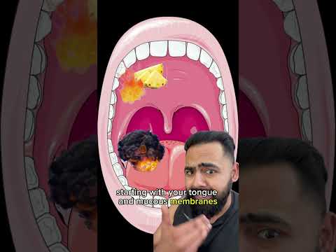 Doctor Explains Why Your Mouth Tingles After Eating Pineapple!