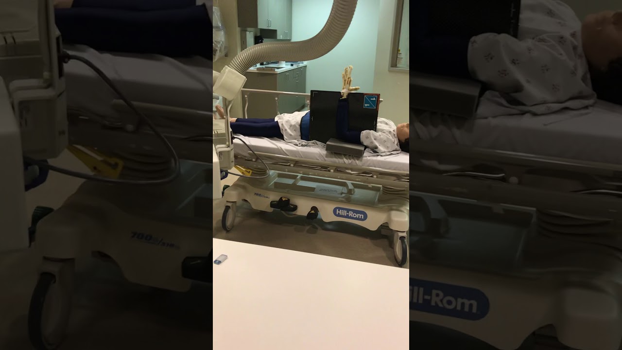 Coyle method for Radial Head in stretcher