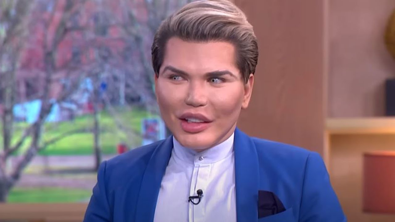 He Was A Famous Actor Before His Plastic Surgery, Guess Who! – Curious ...