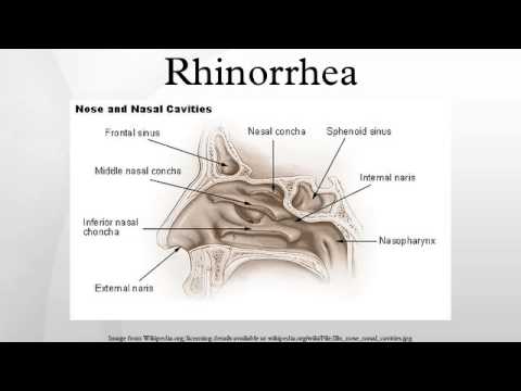 Rhinorrhea