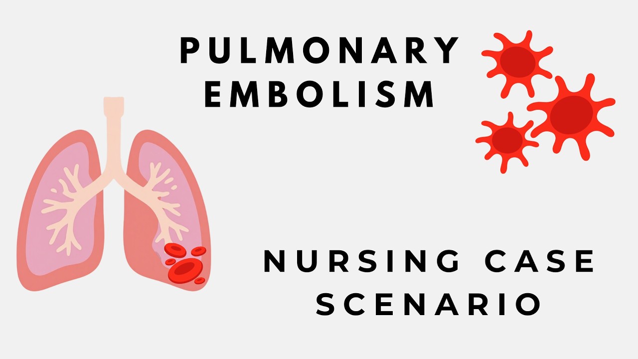 Thinking Like a Nurse: Pulmonary Embolism Case Study (TCJM)