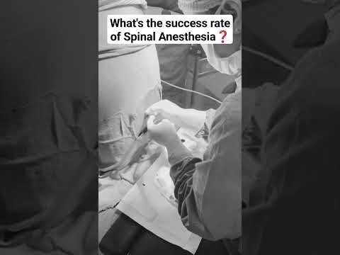 What's the success rate of Spinal Anesthesia #doctor #mbbs #neet #medical #anesthesia #anaesthesia