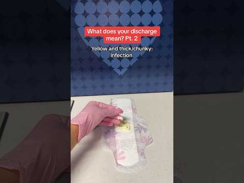 What does your discharge mean? #health #doctor #youtubeshorts #shorts #shortvideo #short #shortsfeed
