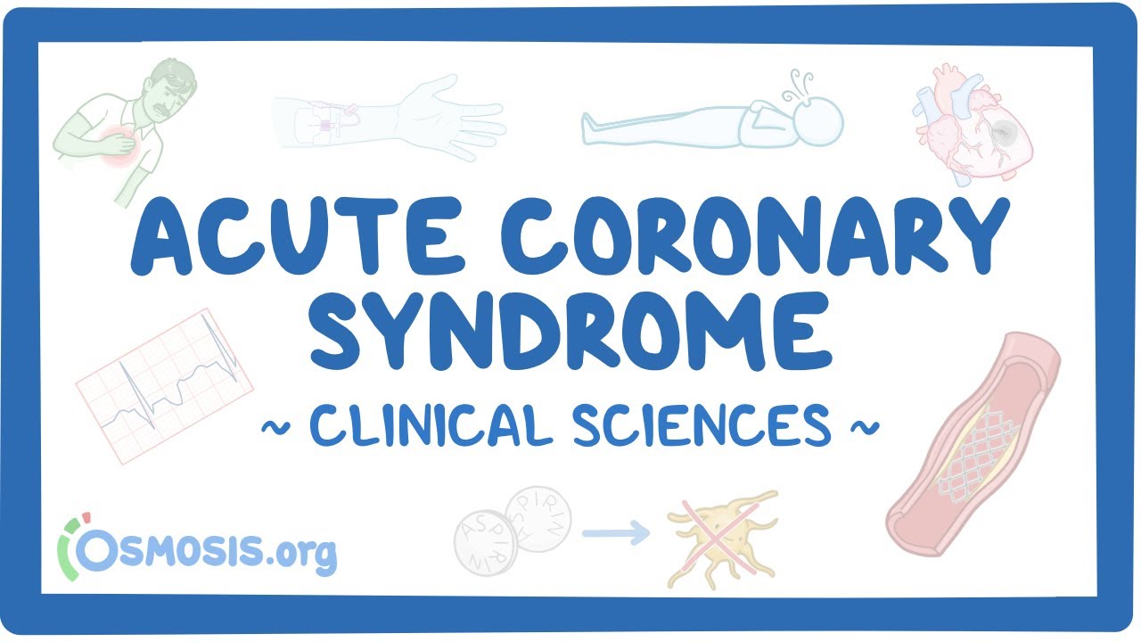 Acute coronary syndrome: Clinical sciences