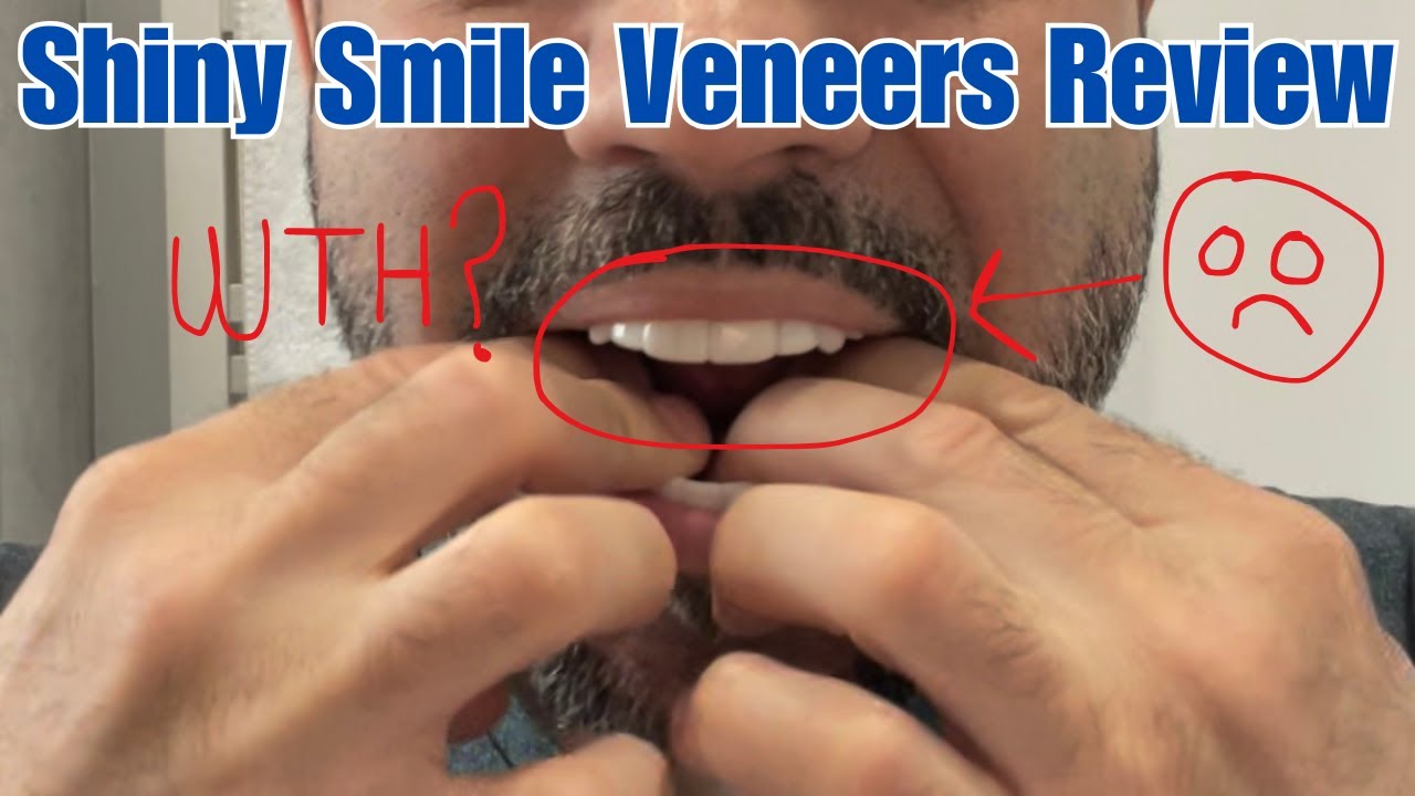 Shiny Smile Veneers Review - Are Shiny Smile Veneers The Best Snap On Veneers?
