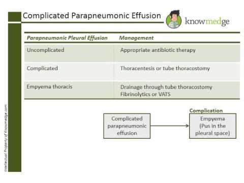 Internal Medicine ABIM Board Exam Review Question: Increasing Pleural Effusion