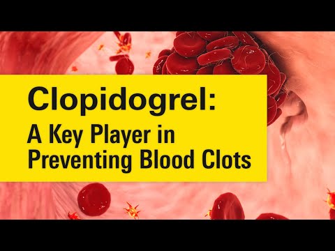 Clopidogrel Explained: Expert Insights and FAQs