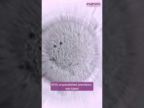 How does Intracytoplasmic Sperm Injection work? #ICSI