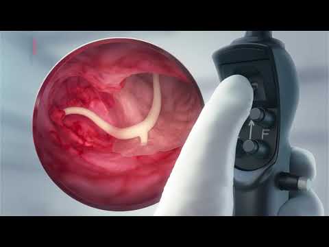 Discover the PROvido surgical microscope with FusionOptics