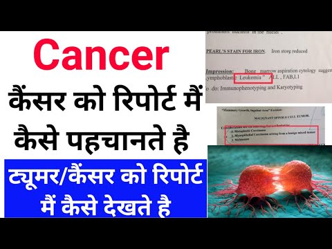 Cancer ( कैंसर) को रिपोर्ट मैं कैसे पहचानते है || Cancer/tumor report देखना सीखे