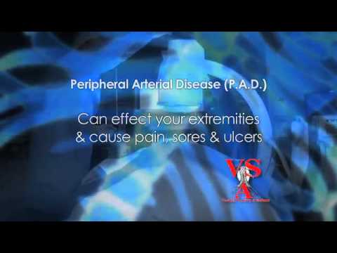 Peripheral Arterial Disease (Dr. Kaelin) - Vascular Surgery Associates