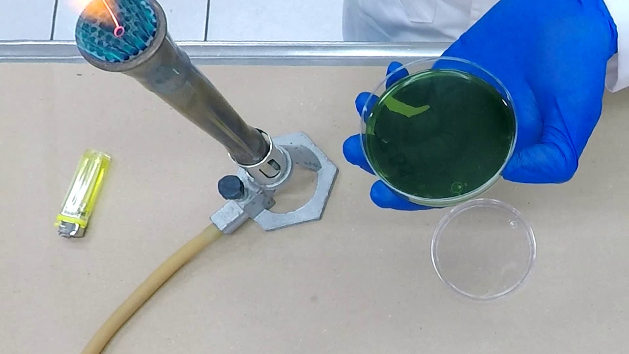 Procedimiento de un coprocultivo