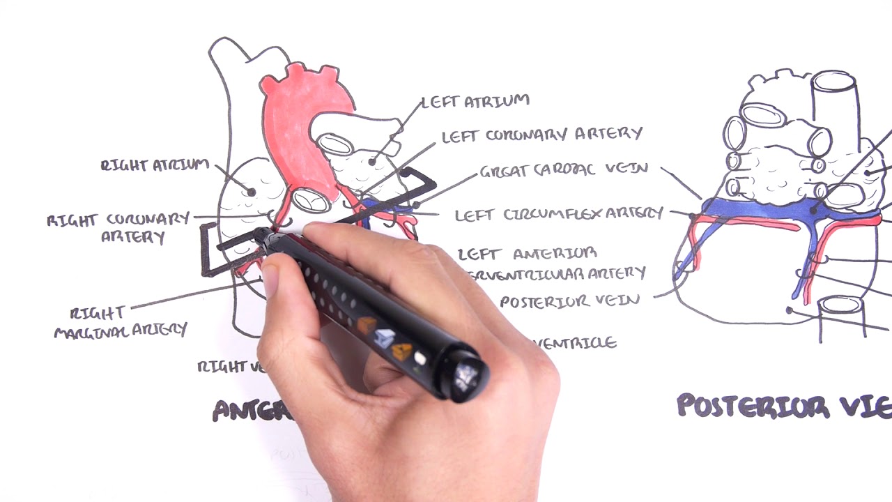 Clinical Anatomy - Cardiac Coronary Vessels (left and right coronary artery, venous sinus)