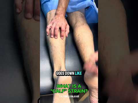What is a calf strain? How do I treat a calf strain?