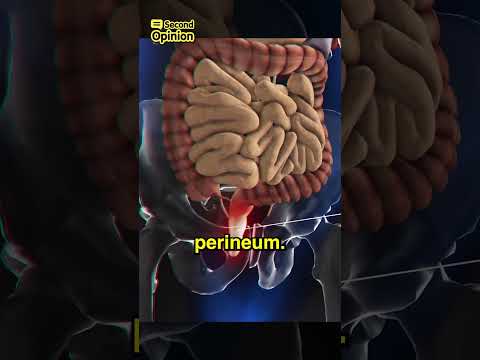 π¨ Cauda Equina Syndrome π¨ Watch full video now @MedTalkSG
