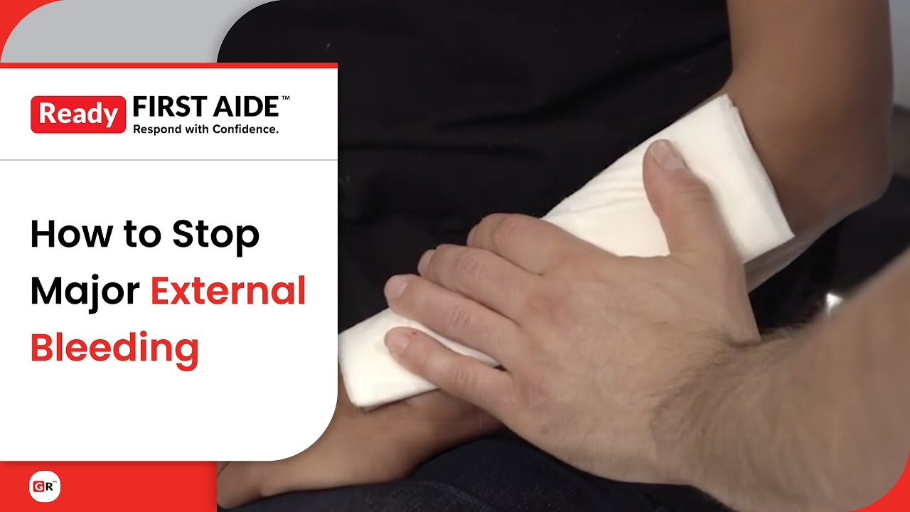 How to Stop Major External Bleeding | Life-Saving First Aid