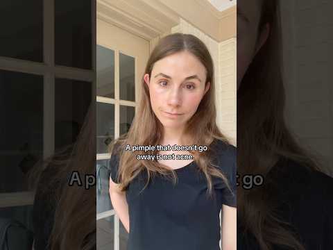 Stubborn Pimple Refusing To Budge!