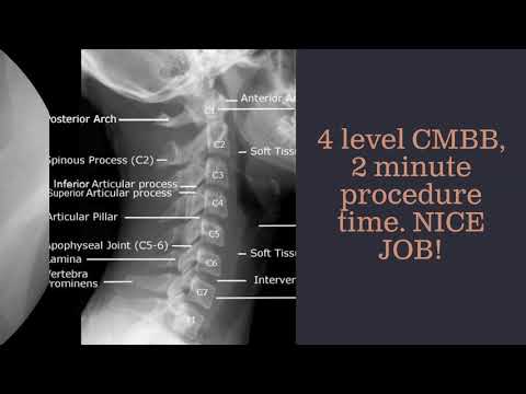 2 Minute Cervical Medial Branch Block