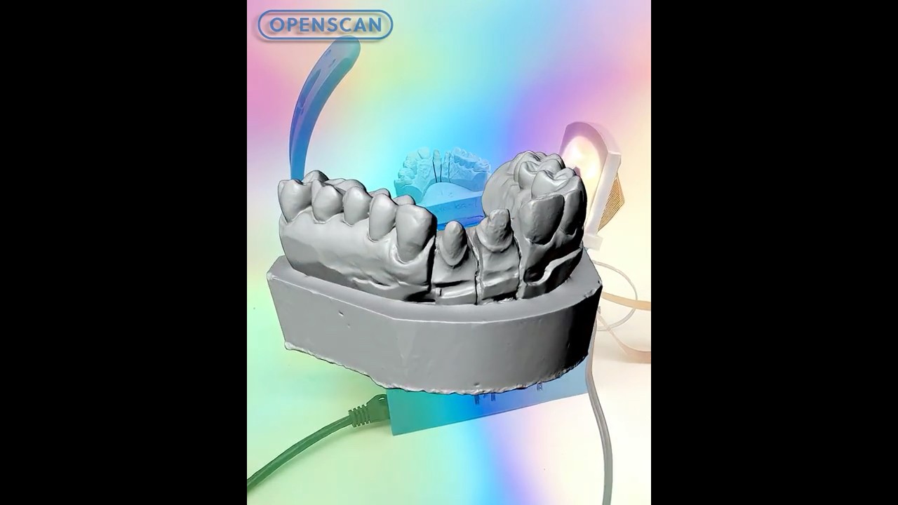 OpenScan Mini - 3D Scanning & Printing an accurate 🫦 Dental Model  #3dprinting #dental #3dscanning