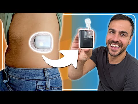 I Switched From Omnipod to Mobi – Here's How it Went