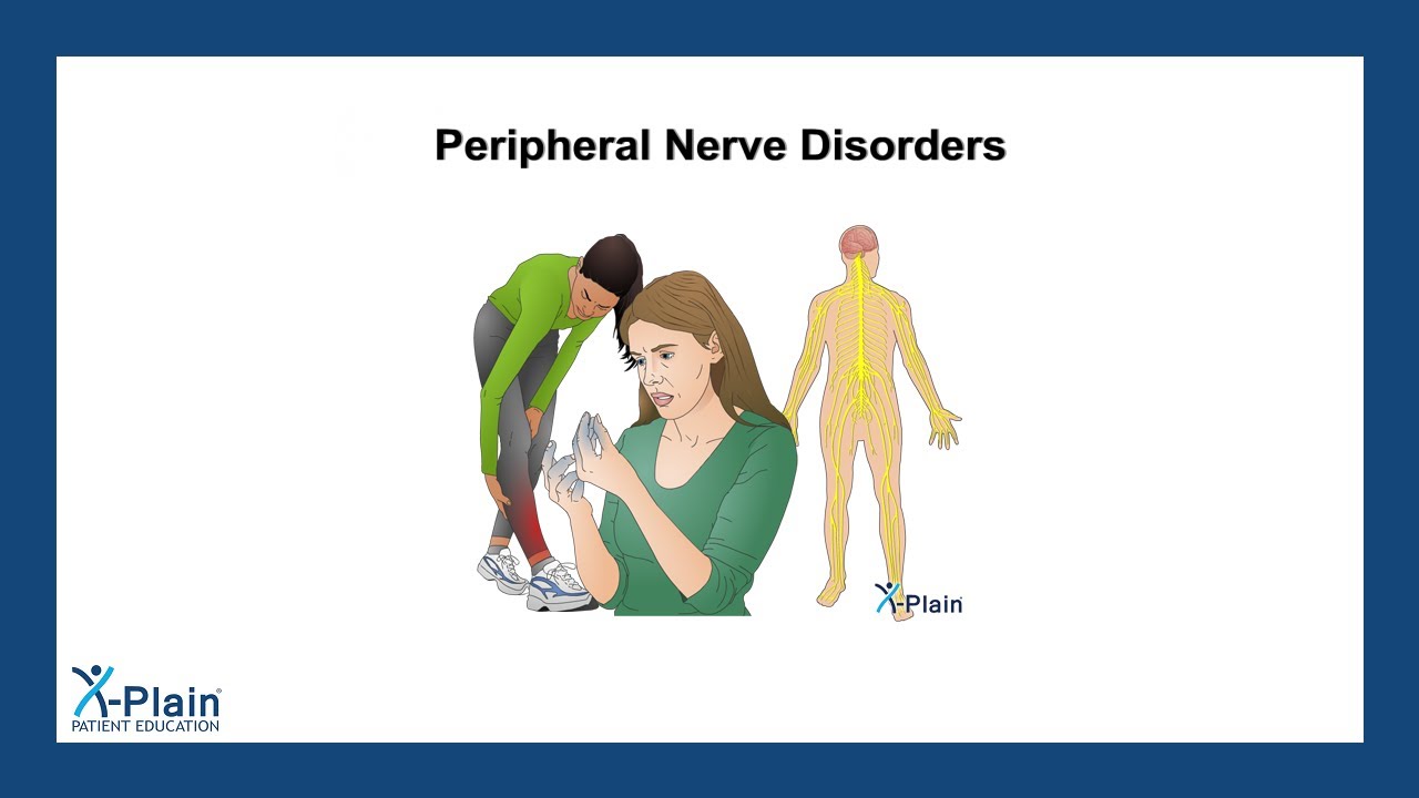 Peripheral Nerve Disorders