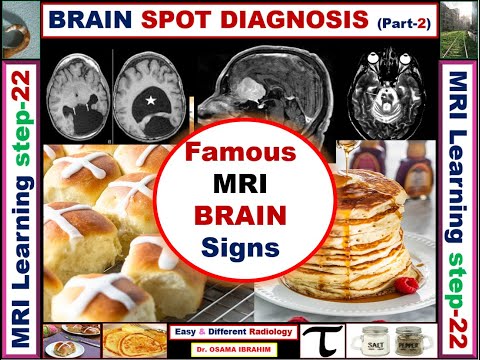 MRI Brain signs and spot diagnosis (part 2)' MRI learning episode- 22