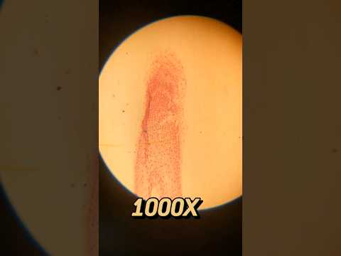 Secrets of Mitosis Anaphase: Amazing Microscopic World 👀🔬