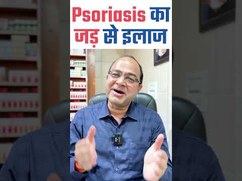 Psoriasis का जड़ से इलाज। Cure Psoriasis With Homeopathy | Best Treatment of Psoriasis