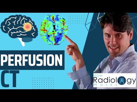Perfusion CT for Acute Ischemic Stroke