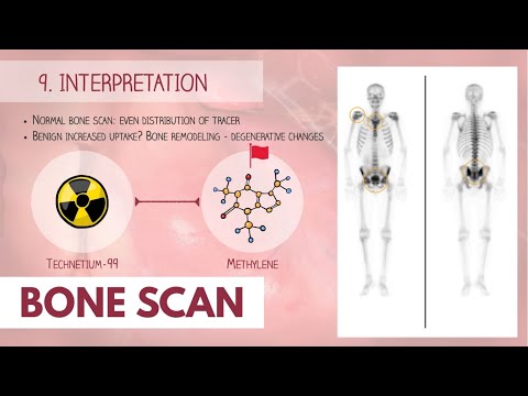 Bone Scan Procedure | Dr. Paulien Moyaert