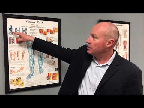 How Leaky Vein Valves Lead to Varicose Veins (Andrew Jones, MD)