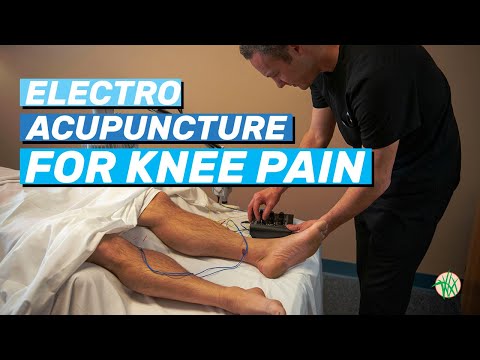 Electroacupuncture for Knee Pain