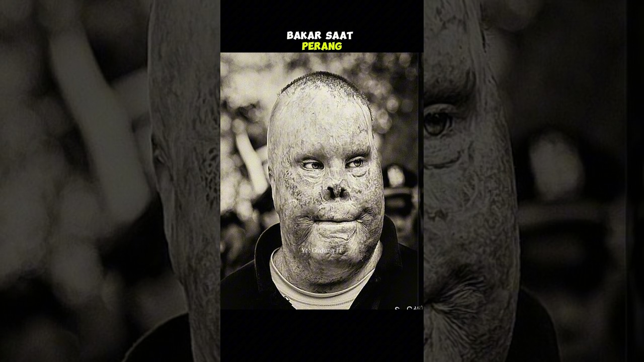 PERBEDAAN TENTARA SEBELUM DAN SESUDAH PERANG