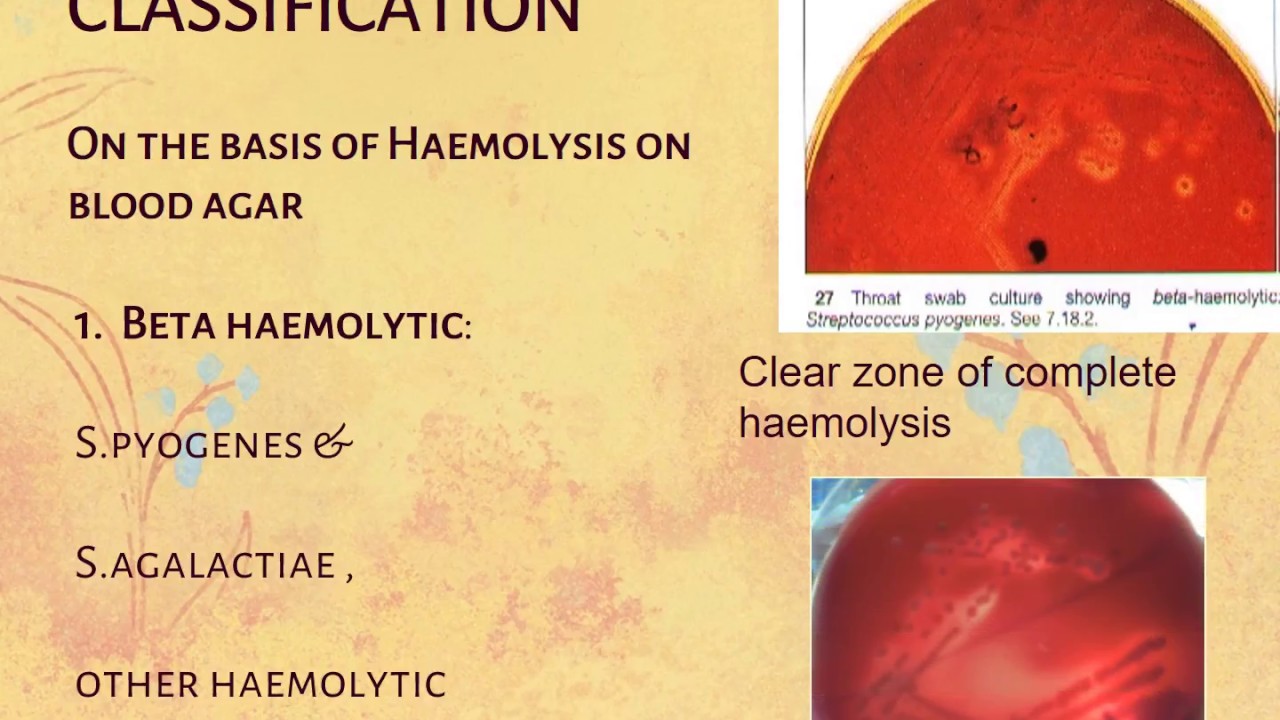 Streptococcus PPT (Slide Presentation)