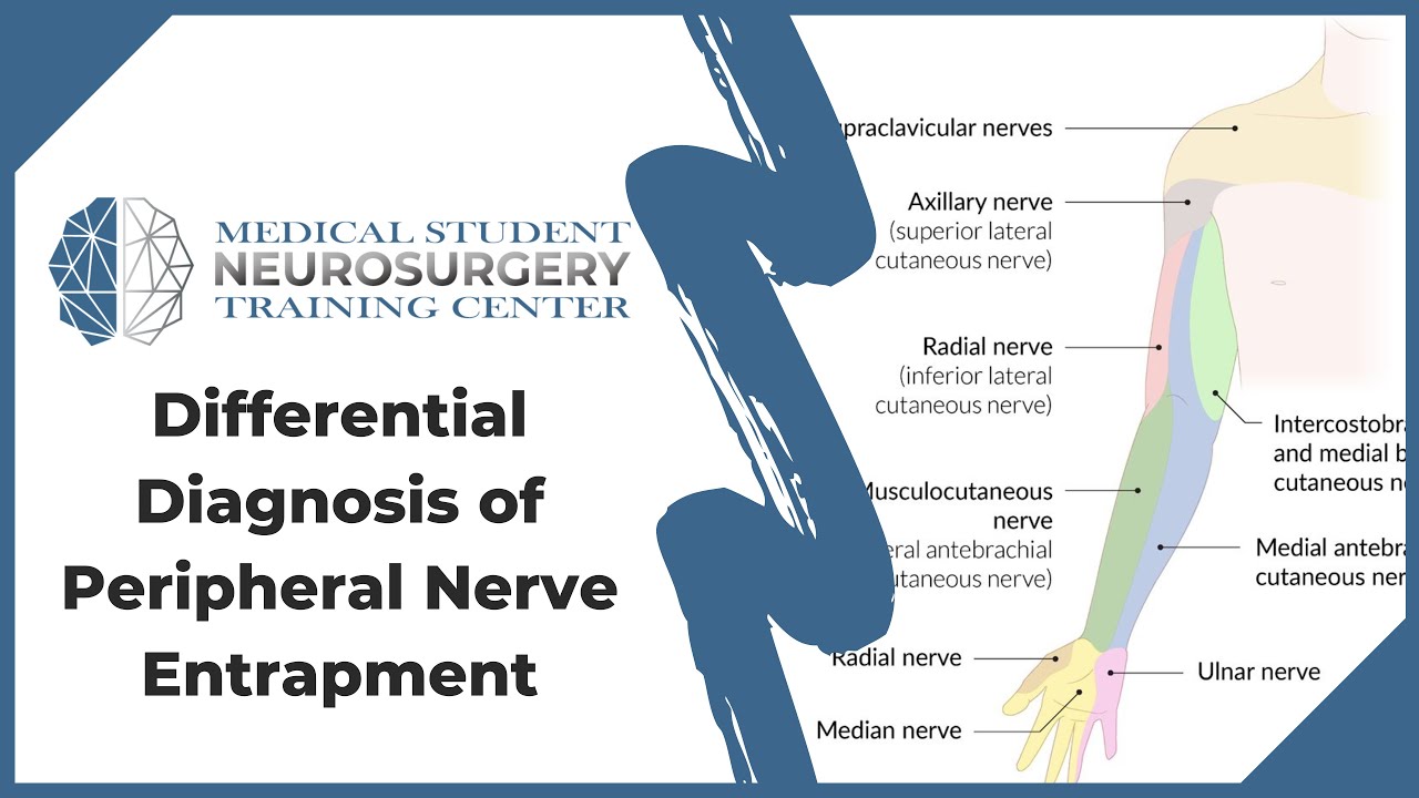 Differential Diagnosis of Peripheral Nerve Entrapment