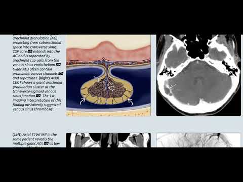 Head and neck radiology diagnostic imaging series images only(3)