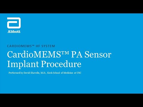 CardioMEMS PA Sensor Implant Procedure
