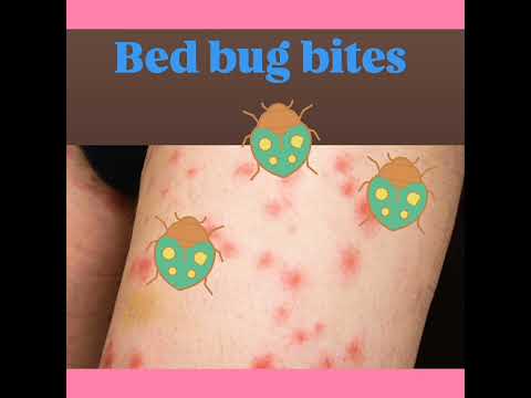 Blood sucking ectoparasites🩸Bed bugs🩸Cimex lectularius🩸Parasitic insects🩸👍Parasitology👍🔬✅