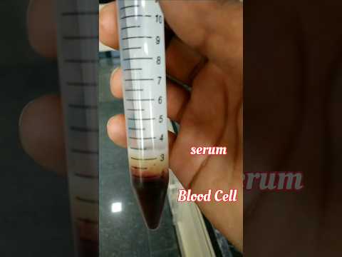How to separate blood Cell and serum | serum from plasma | #blood | #serum | #shorts | #trending |