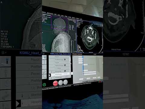 Brain Angiography | Angiography | CT scan | live scan #siemens #video #trending #ctscan #anatomy