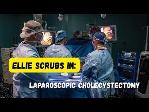 Ellie Scrubs In: Laparoscopic Cholecystectomy | Step-by-Step Gallbladder Surgery