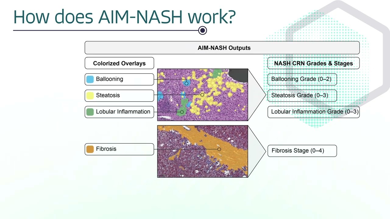 AI-based NASH Scoring: AIM-NASH by PathAI