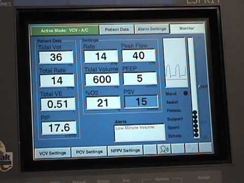 Philips Respironics Esprit Ventilator, Price from Rs.300000/unit ...