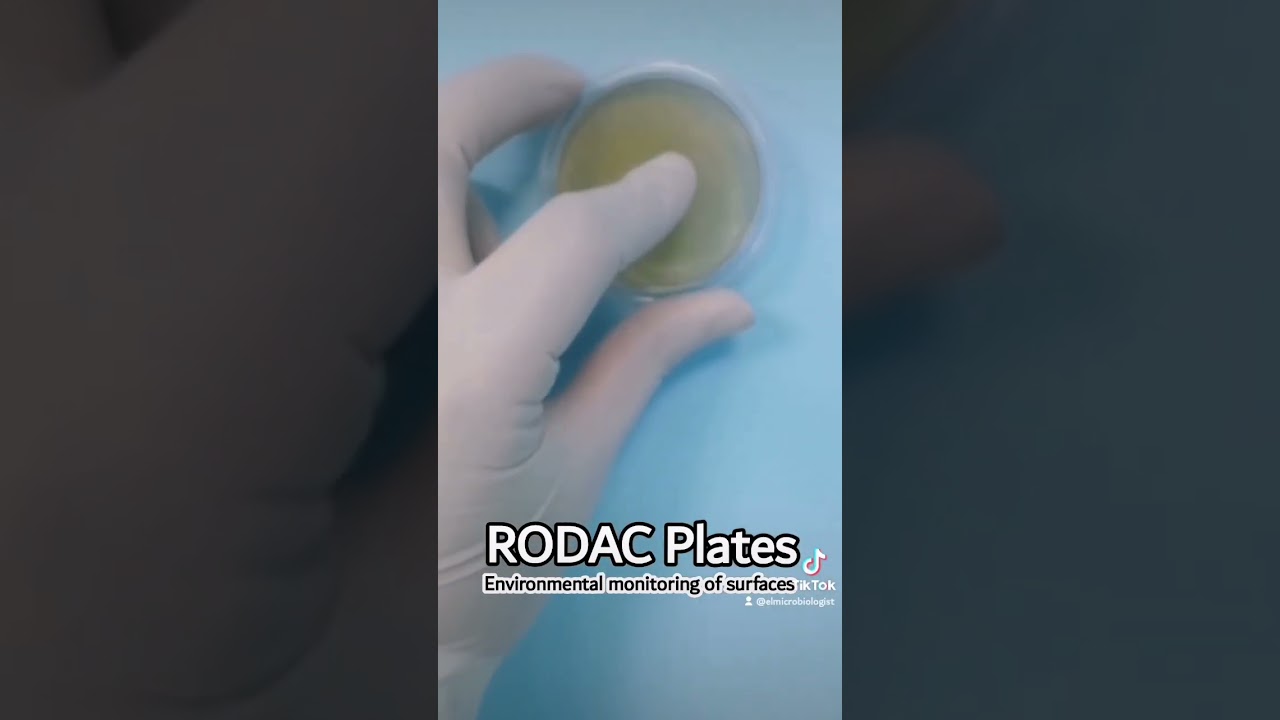 Environmental monitoring by using RODAC Plates (Contact plate for surfaces)
