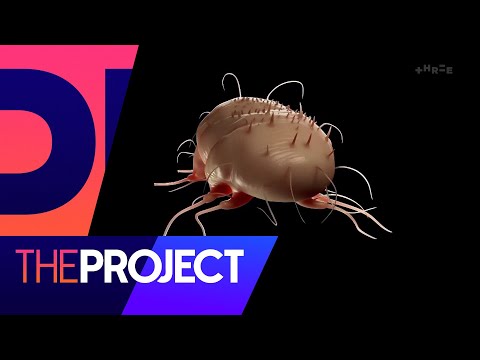 Explainer: How to get rid of scabies | The Project NZ