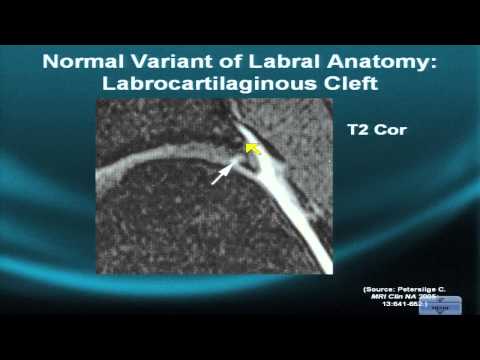 MRI Online: Hip Imaging, Part XI