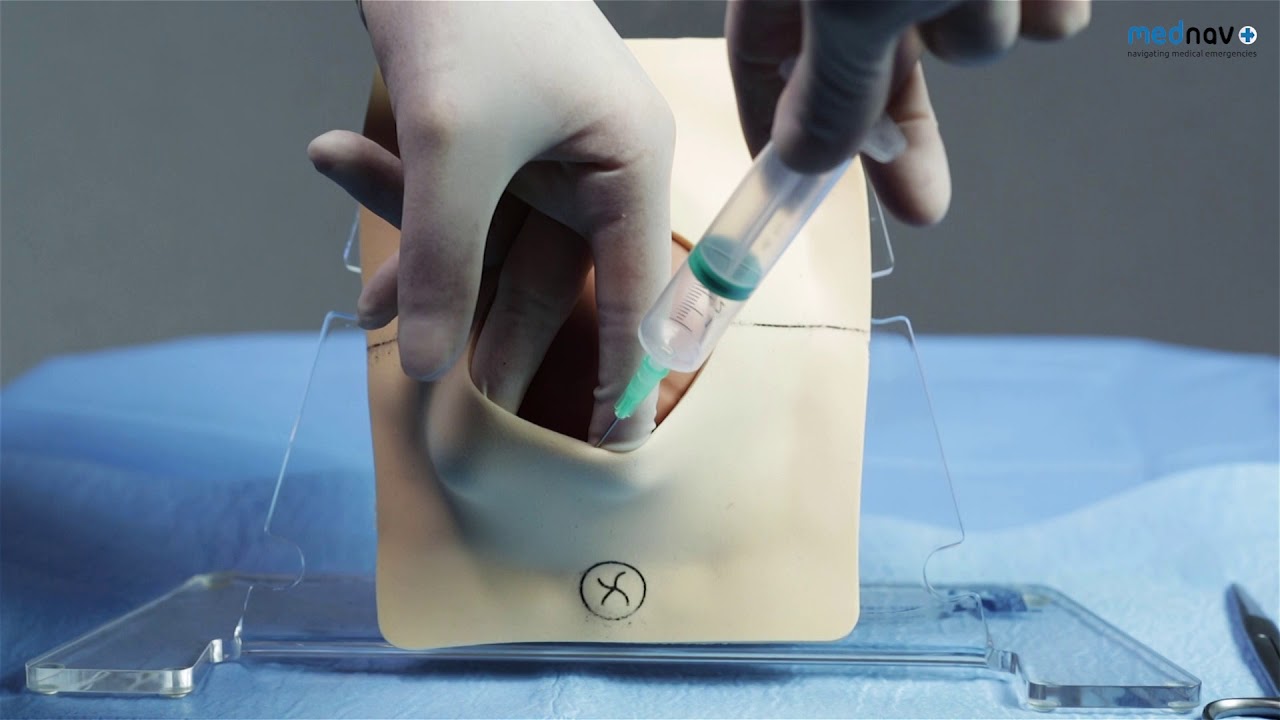 How to Perform an Episiotomy