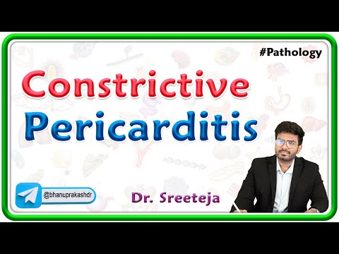 2: Constrictive Pericarditis | Pathology USMLE Step 1