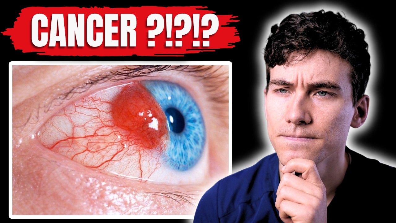 Do Sunglasses Cause Skin Cancer?! The Truth From an Eye Doctor